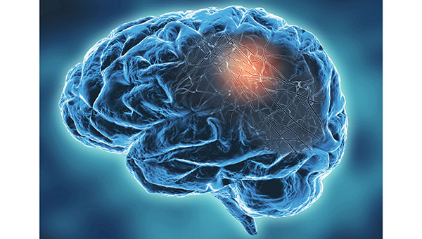 Nanoparticle drug-delivery system developed to treat brain disorders ...