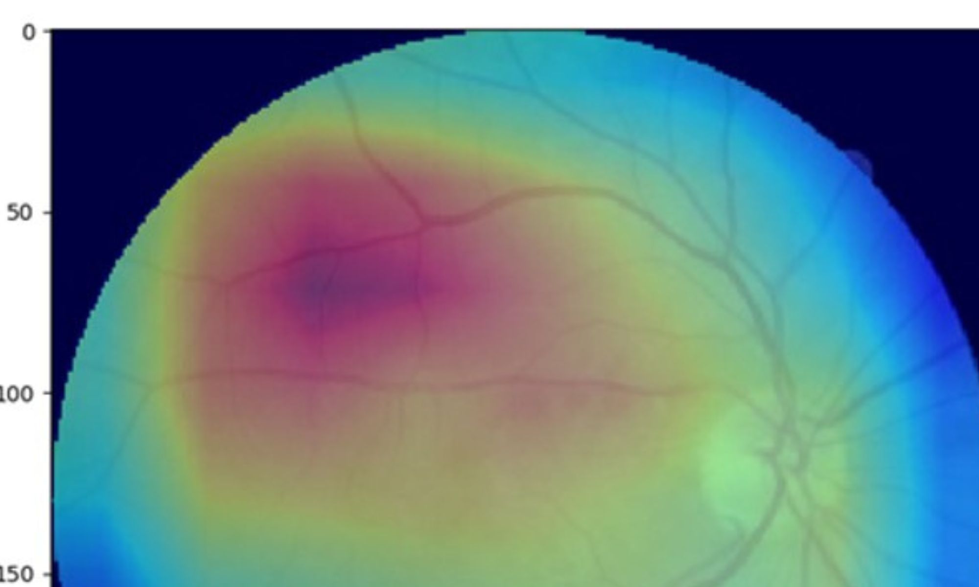 Study reveals the eye is the window to the heart | Laboratory News